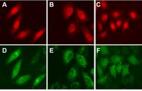 LentiBrite™ RFP-LC3 Control Mutant Lentiviral Biosensor | 17-10188